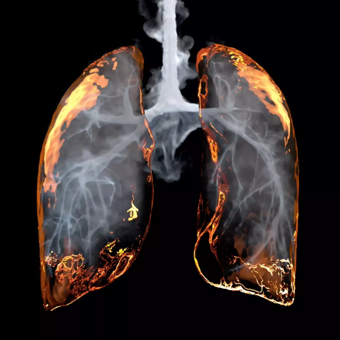 Turning the Tide: The CDC’s Person-First Approach to Stopping Overdose ...